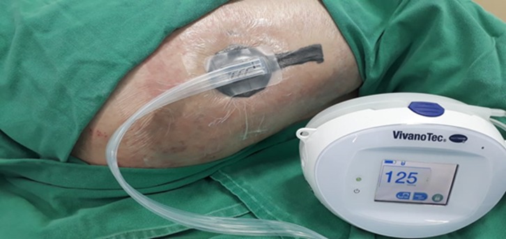 Hospital Unimed Noroeste/RS tem grupo especializado no tratamento de ...